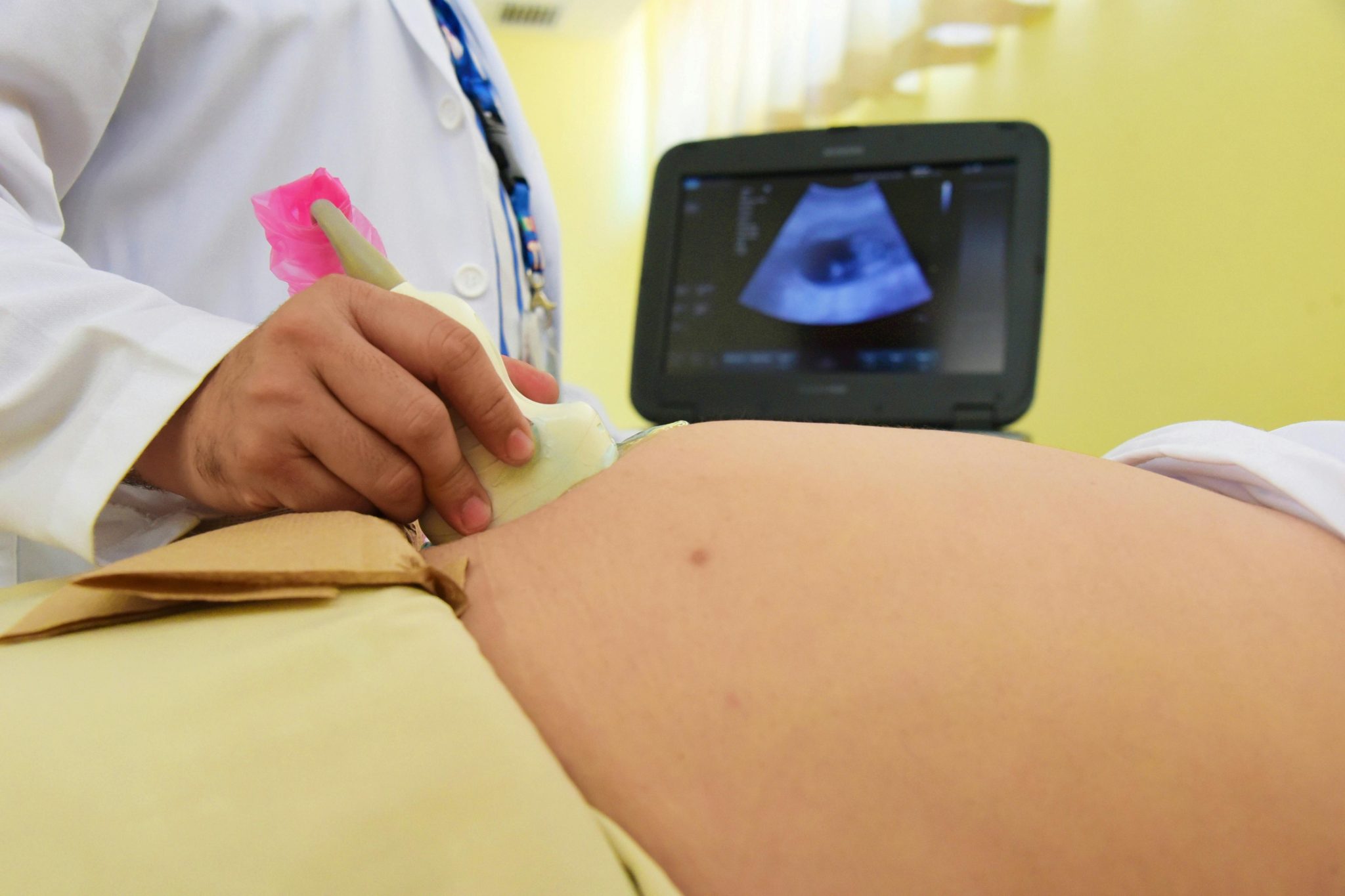 Understanding Ovarian Hyperstimulation Syndrome (OHSS) - Midwest ...